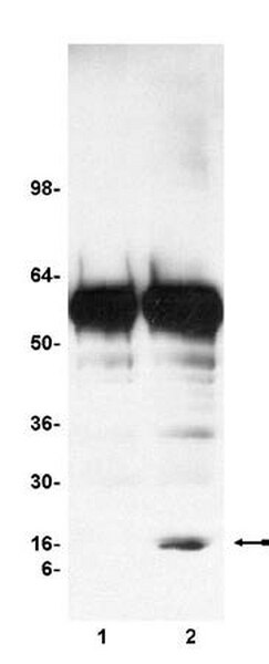 Chromatin Immunoprecipitation (ChIP) Assay Kit | 17-295